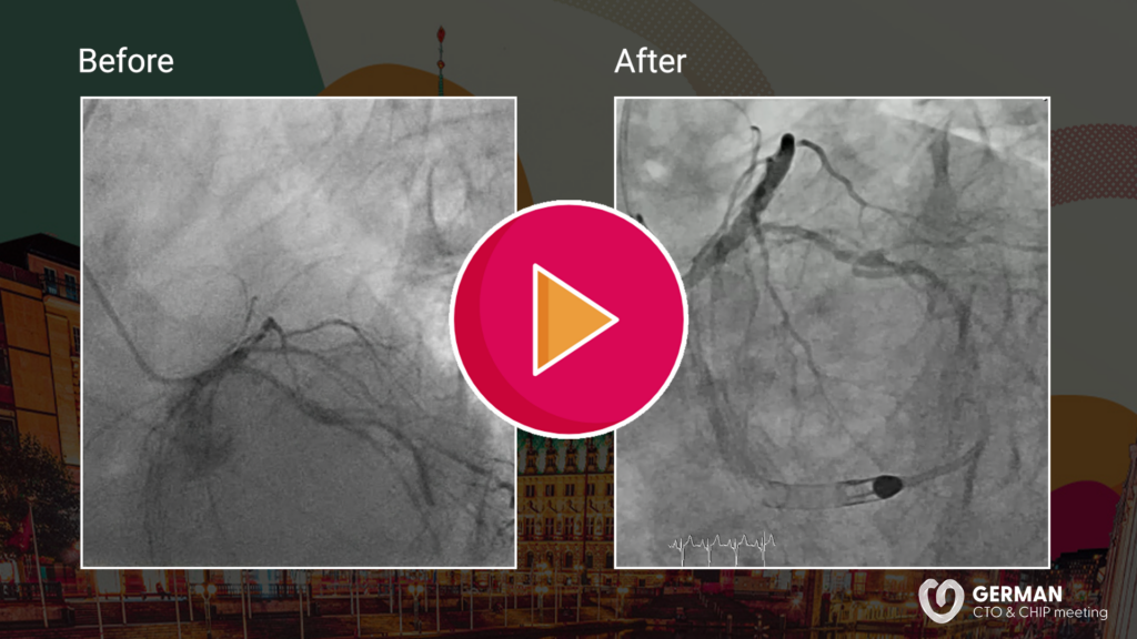 Replay 2024 - German CTO & CHIP Meeting