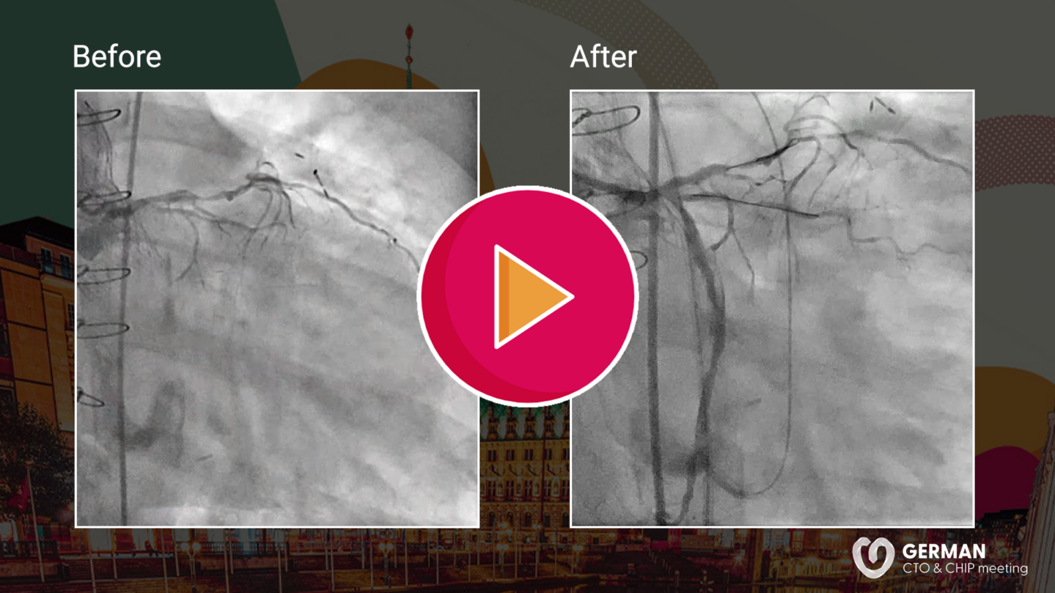 Replay 2024 - German CTO & CHIP Meeting