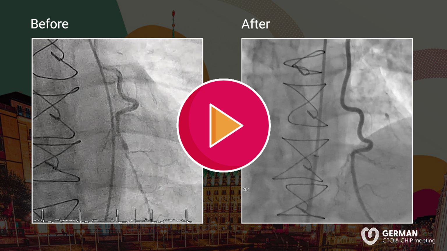 Replay 2024 - German CTO & CHIP Meeting