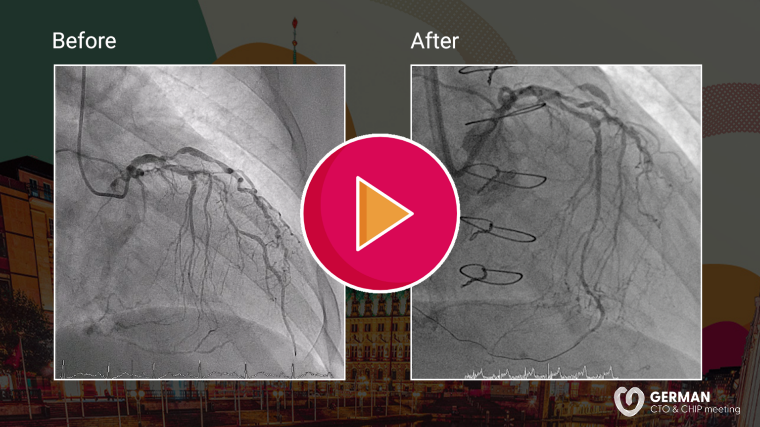 Replay 2024 - German CTO & CHIP Meeting