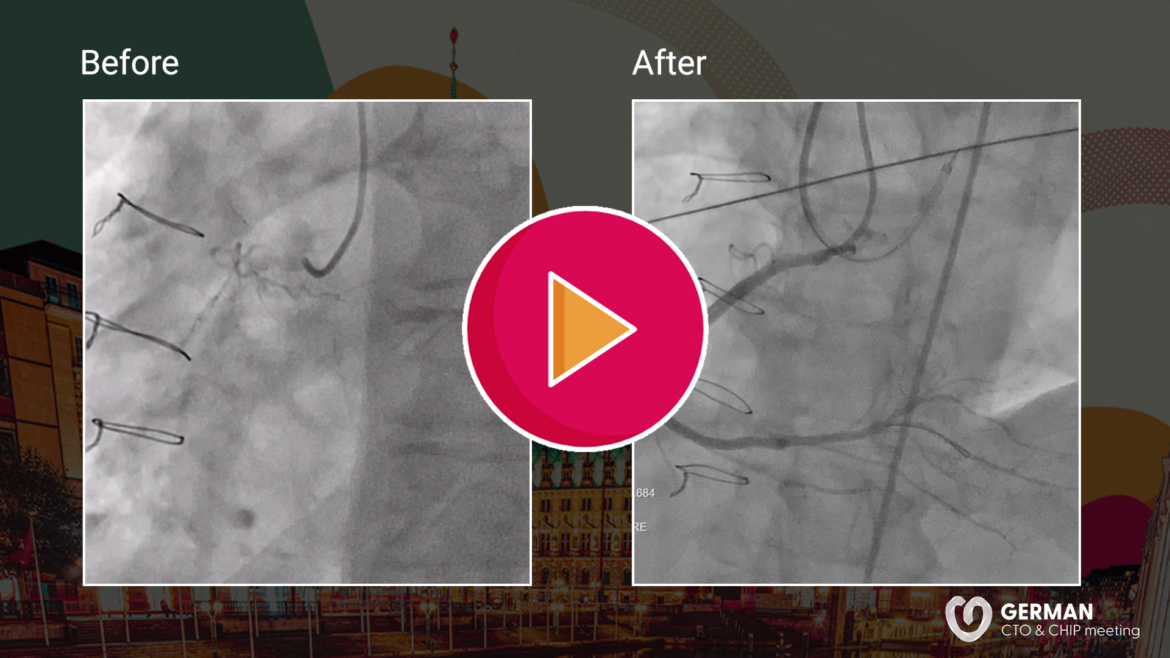 Replay 2024 - German CTO & CHIP Meeting